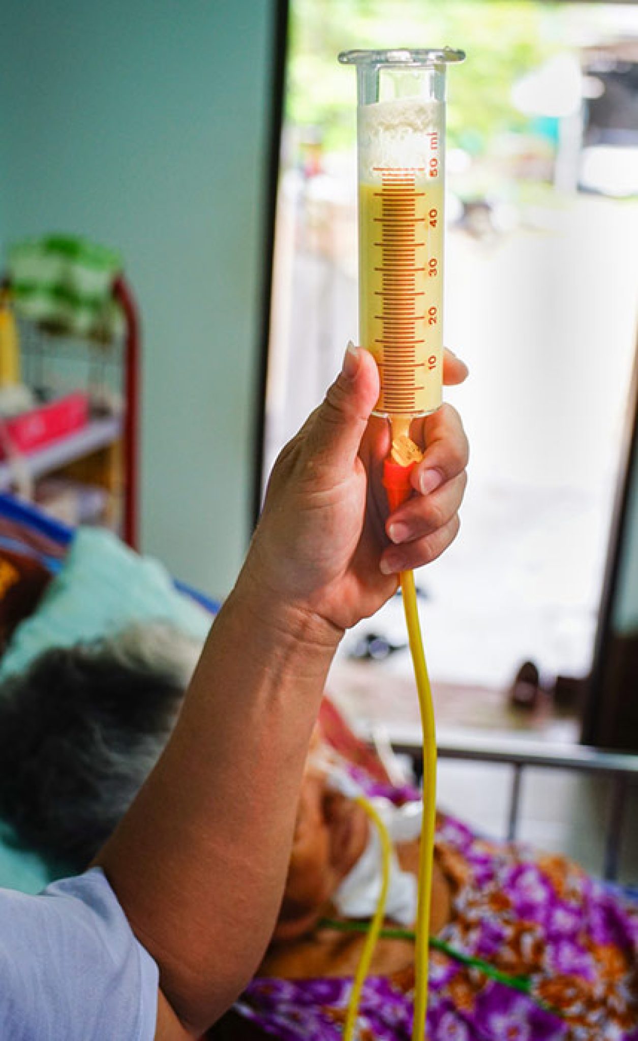 What Is Home Enteral Nutrition-All You Need to Know! - KIQ PLAN